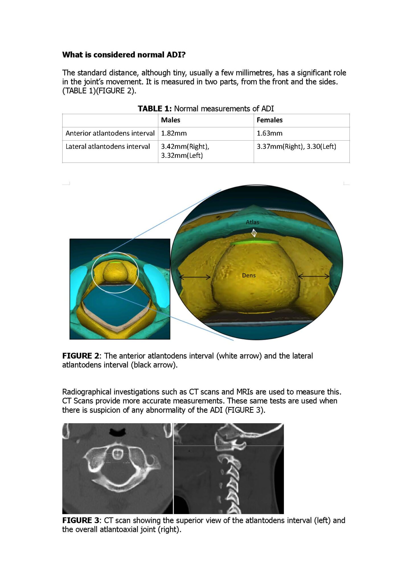 Atlanto-dental Interval (ADI)
