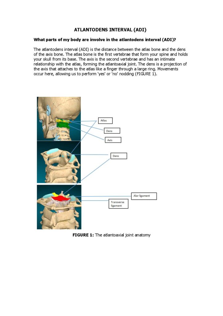 Atlanto-dental Interval (ADI)